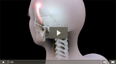 Study Finds MRI "Overused" for Back Pain - Chiropractic News by ChiroNexus