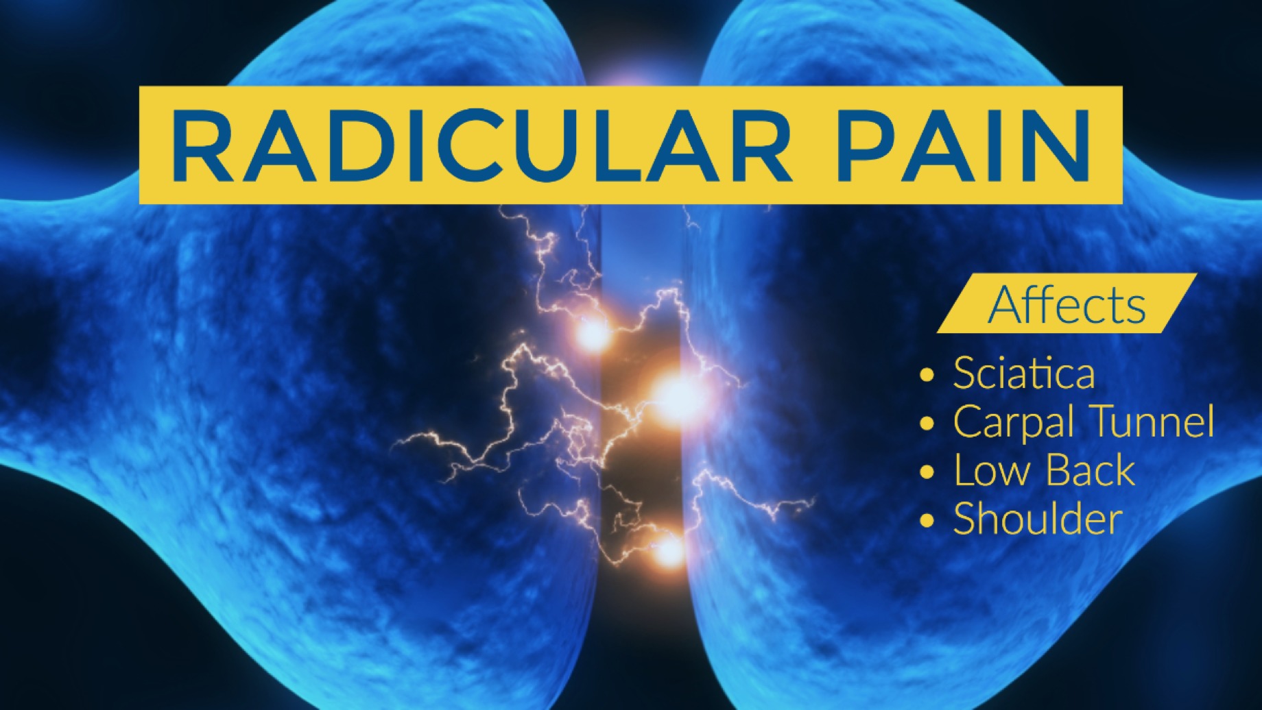 VIDEO: Chiropractic for Radicular Pain | Chironexus News